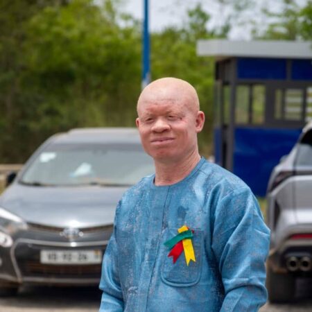 GAPA Commemorates 2026 International Albinism Awareness Day Under the ...